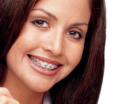 Orthodontist Orange County, CA | Braces
